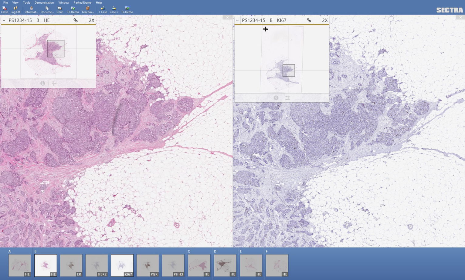IDS7 Pathologie Basis (20.x)